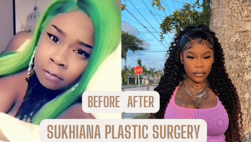 Sassy Rapper Sukihana Plastic Surgery Revealed with 100% Facts!