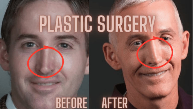 Trey Gowdy Plastic Surgery: Nose Job Speculations 2024