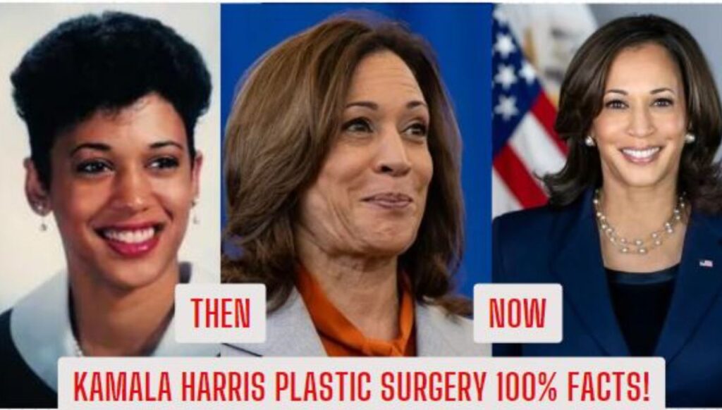 US Vice President Kamala Harris Plastic Surgery 100% Facts!
