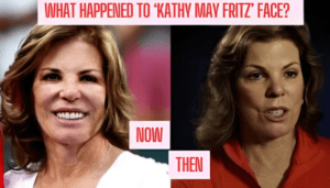 Taylor Fritz Mother Kathy May Fritz Face Surgery Disaster!