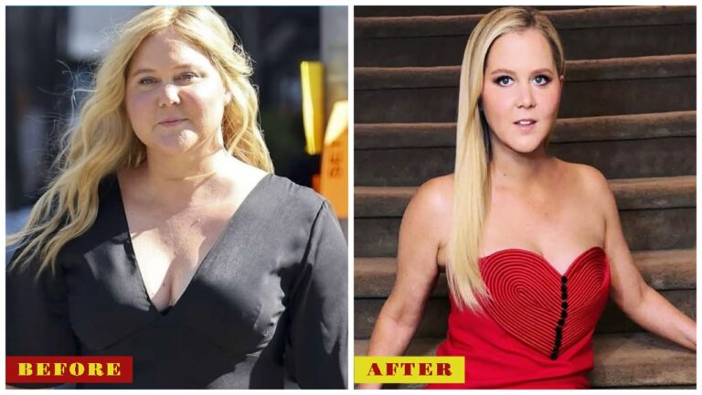 Amy Schumer 2025 Weight Loss Divorce Life Today